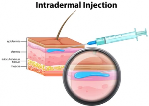 Types of Injection Techniques – HVAX | Turnkey Pharma Projects